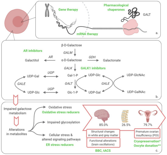 Current and Future Treatments for Classic Galactosemia