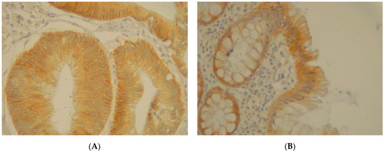 Increased Expression of VANGL1 is Predictive of Lymph Node Metastasis ...