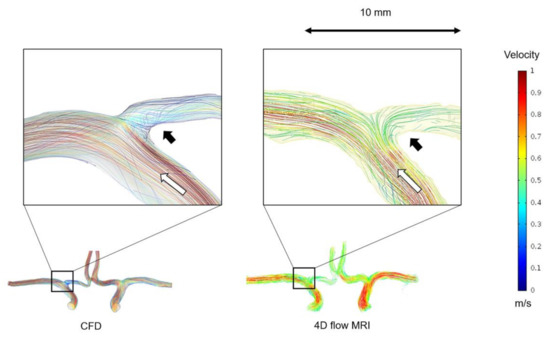 Comparison of Hemodynamic Visualization in Cerebral Arteries: Can ...