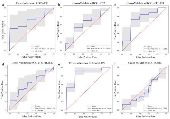 Deep Learning Can Differentiate IDH-Mutant from IDH-Wild GBM