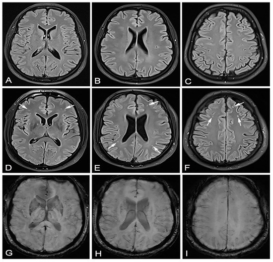 JPM | Free Full-Text | Personalized Approach to Patient with MRI Brain ...