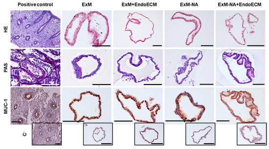 Improved Models of Human Endometrial Organoids Based on Hydrogels from ...