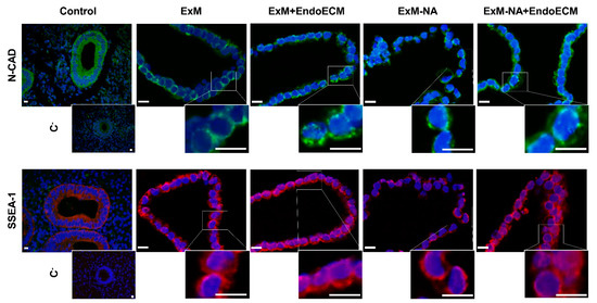 Improved Models of Human Endometrial Organoids Based on Hydrogels from ...