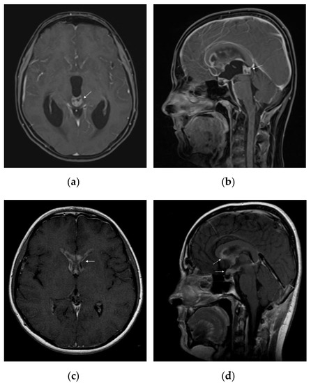 Molecular Pathology and Targeted Therapies for Personalized Management ...