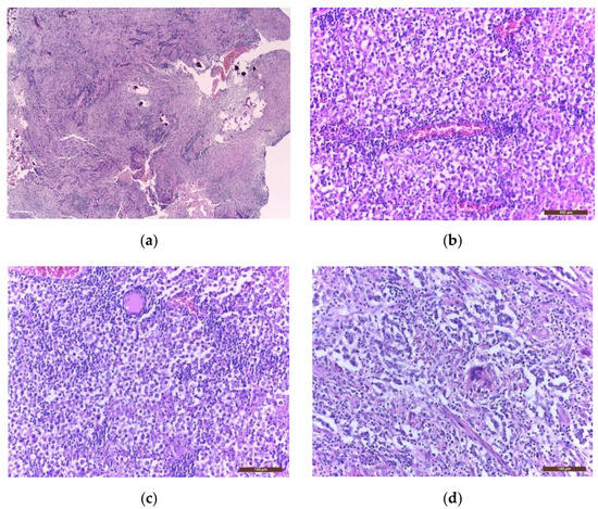 Molecular Pathology and Targeted Therapies for Personalized Management ...