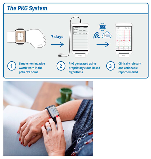 Parkinson’s Disease: Personalized Pathway of Care for Device-Aided ...