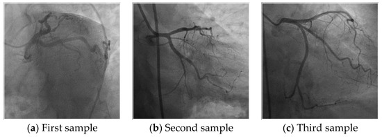 JPM | Free Full-Text | Coronary Angiography Print: An Automated ...