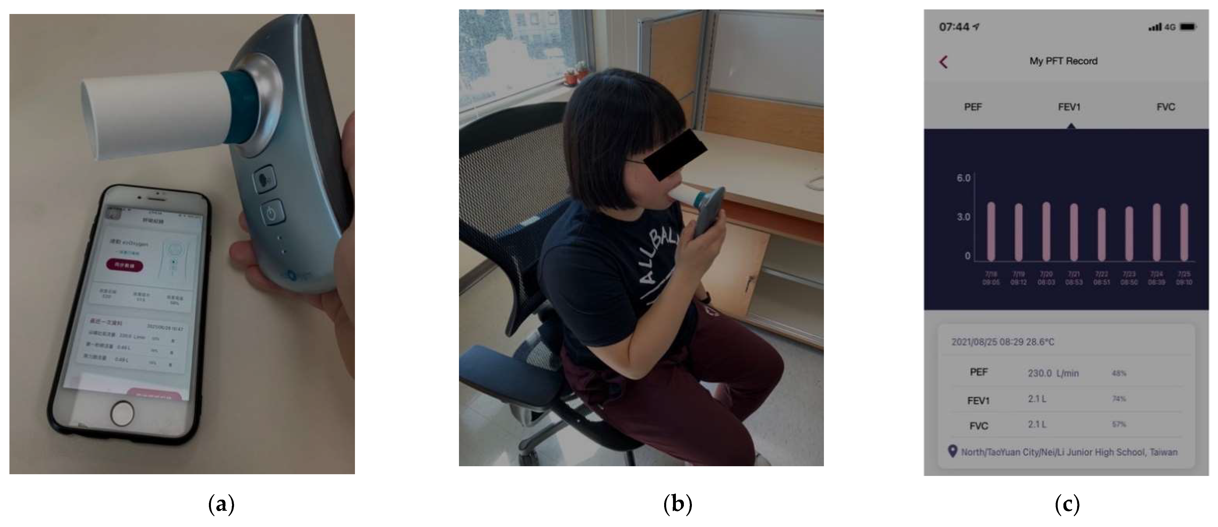 The Feasibility and Efficiency of Remote Spirometry System on the ...