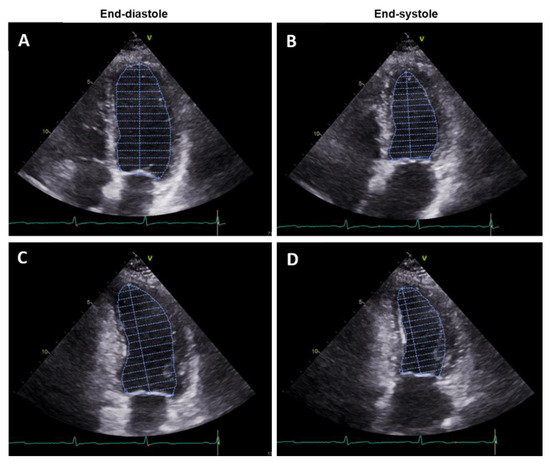 Non-Invasive Assessment of Left Ventricle Ejection Fraction: Where Do ...