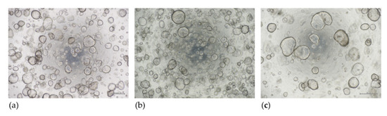 Comparison of Organoids from Menstrual Fluid and Hormone-Treated ...