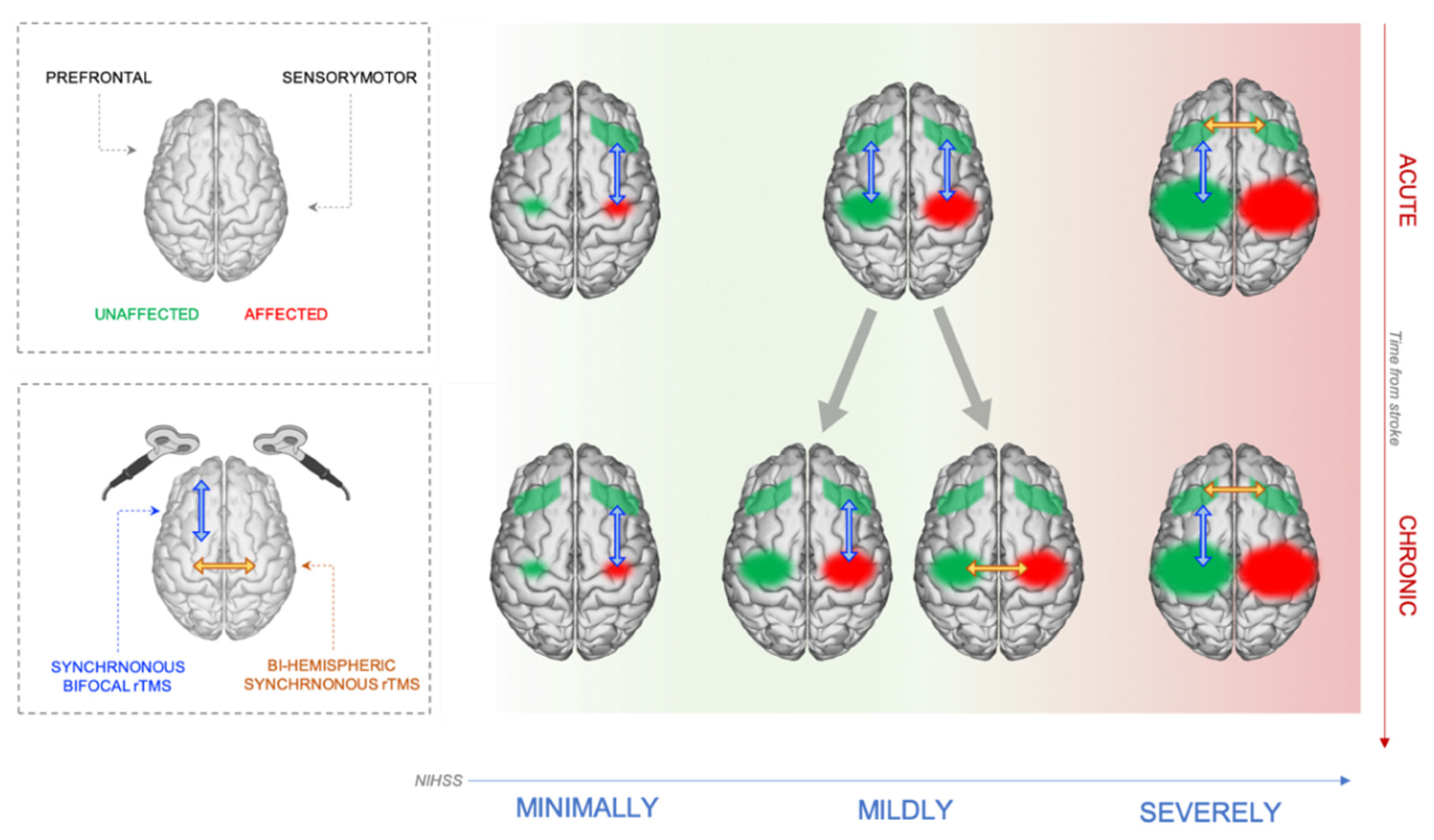A New Framework to Interpret Individual Inter-Hemispheric Compensatory ...