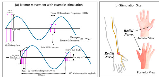 Analyzing the Effects of Parameters for Tremor Modulation via Phase ...