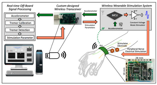 JPM | Free Full-Text | Analyzing the Effects of Parameters for Tremor ...
