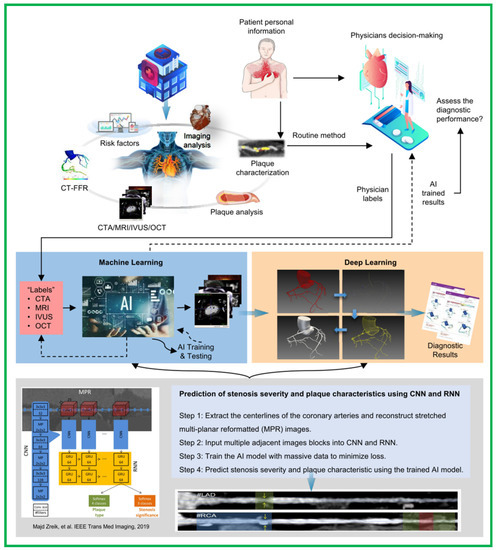 Artificial Intelligence in Cardiovascular Atherosclerosis Imaging