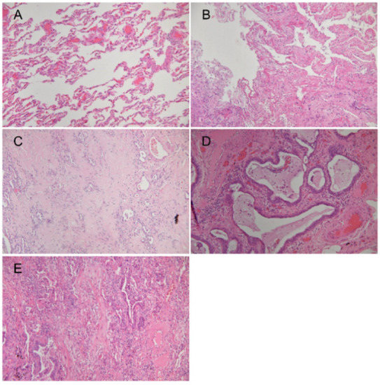 Relationship between Mechanical Ventilation and Histological Fibrosis ...