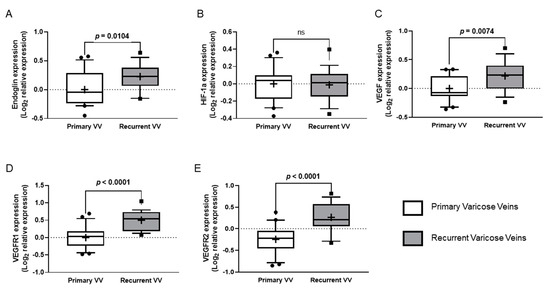 Endoglin and Other Angiogenesis Markers in Recurrent Varicose Veins