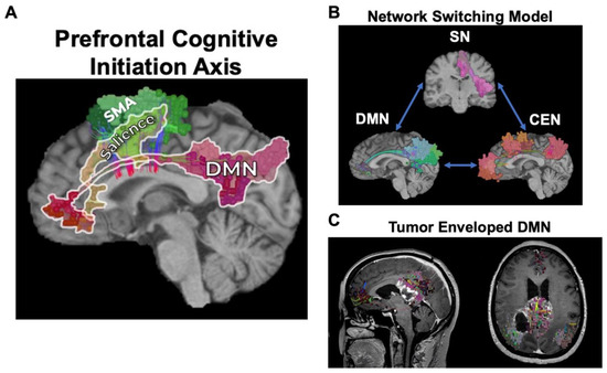 Should Neurosurgeons Try to Preserve Non-Traditional Brain Networks? A ...