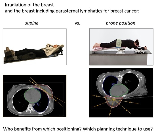 JPM | Free Full-Text | Radiotherapy of Breast Cancer in Laterally ...