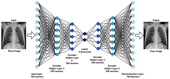 LungNet22: A Fine-Tuned Model for Multiclass Classification and Prediction of Lung Disease Using ...