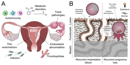 The Role of Endometrial Stem/Progenitor Cells in Recurrent Reproductive ...