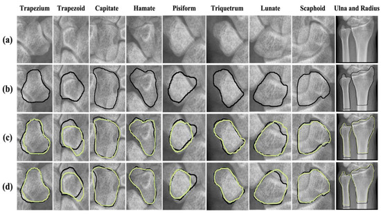 JPM | Free Full-Text | Automatic Segmentation for Favourable ...