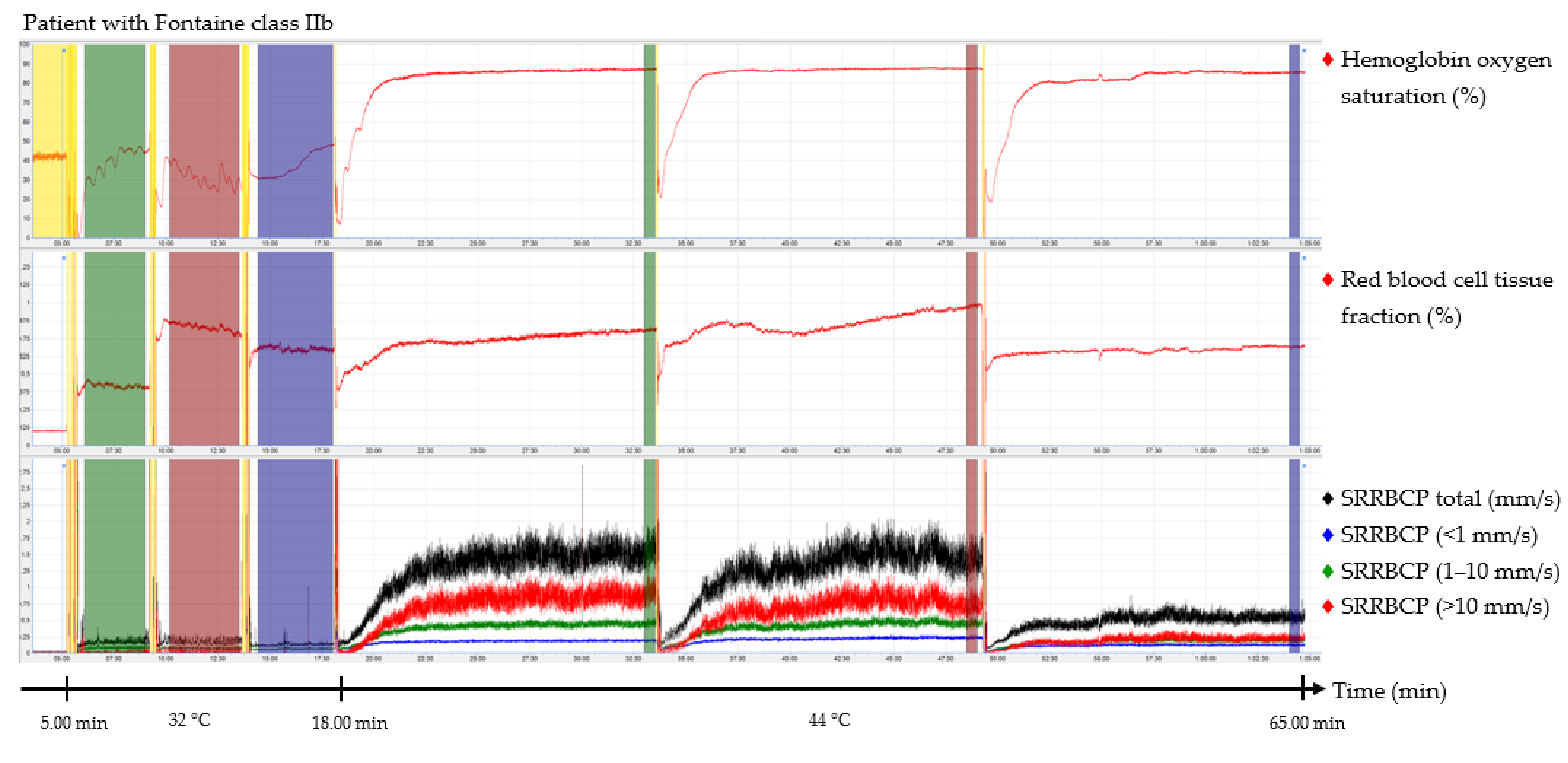 Laser Doppler Flowmetry Combined with Spectroscopy to Determine ...