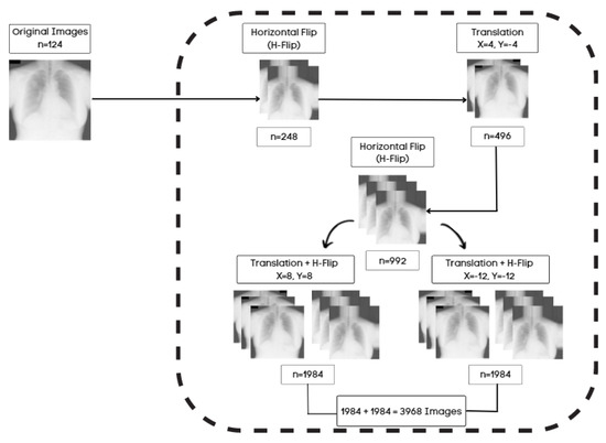 CardioNet: Automatic Semantic Segmentation to Calculate the ...