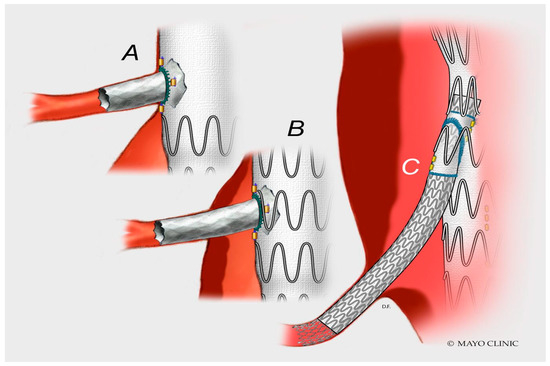 JPM | Free Full-Text | Peri-Operative Management of Patients Undergoing ...