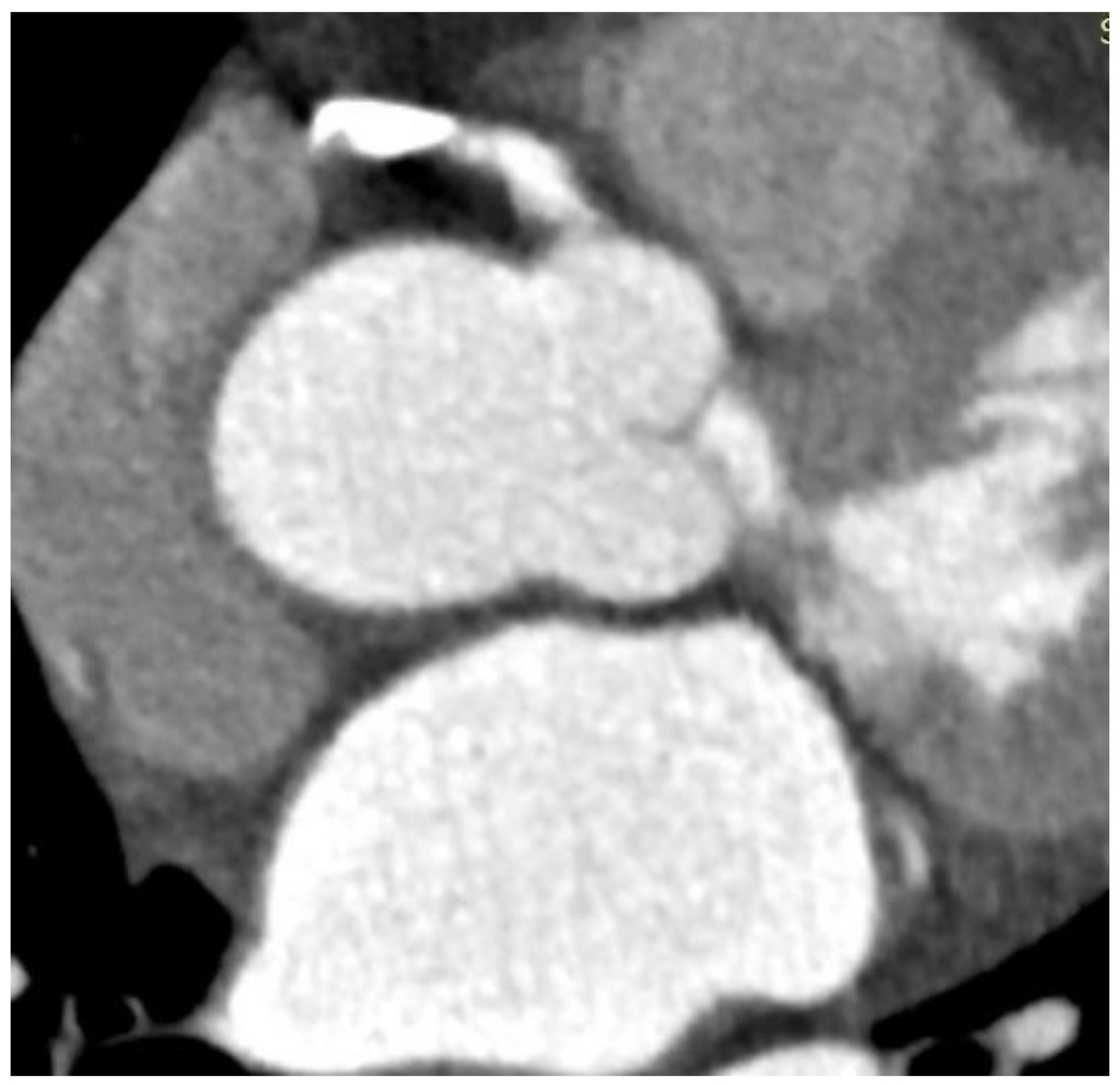 Finetuned Super-Resolution Generative Adversarial Network (Artificial Intelligence) Model for ...