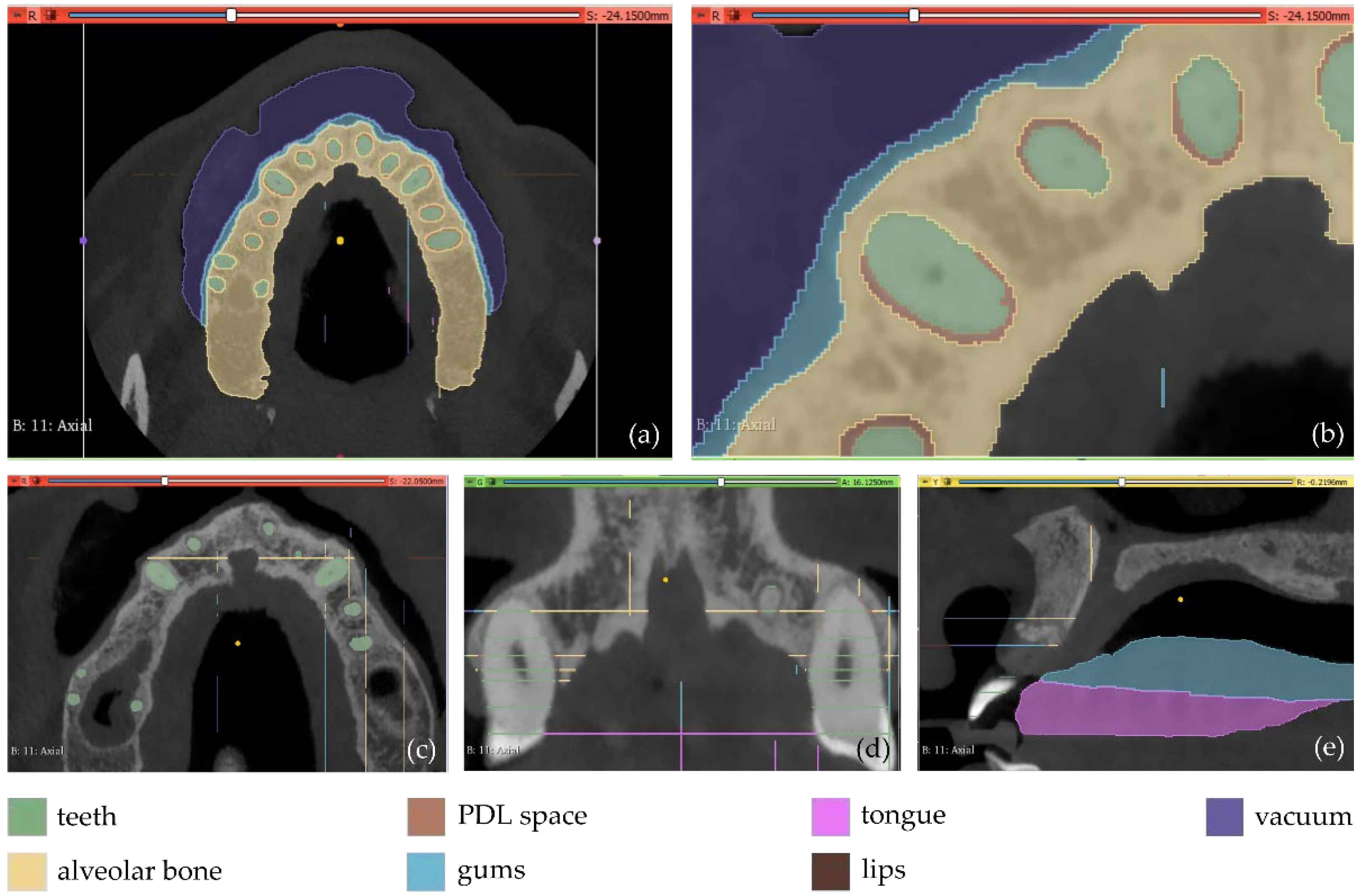 JPM | Free Full-Text | Evaluation of 3D Modeling Workflows Using Dental CBCT Data for ...