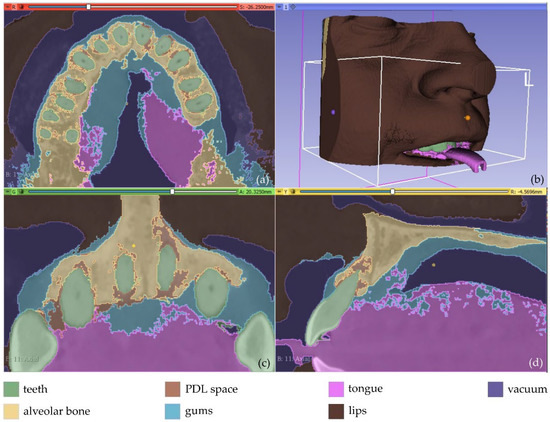 Evaluation of 3D Modeling Workflows Using Dental CBCT Data for ...