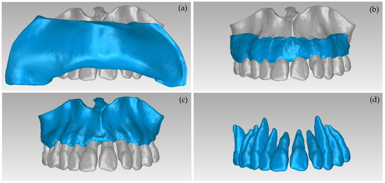 JPM | Free Full-Text | Evaluation of 3D Modeling Workflows Using Dental ...