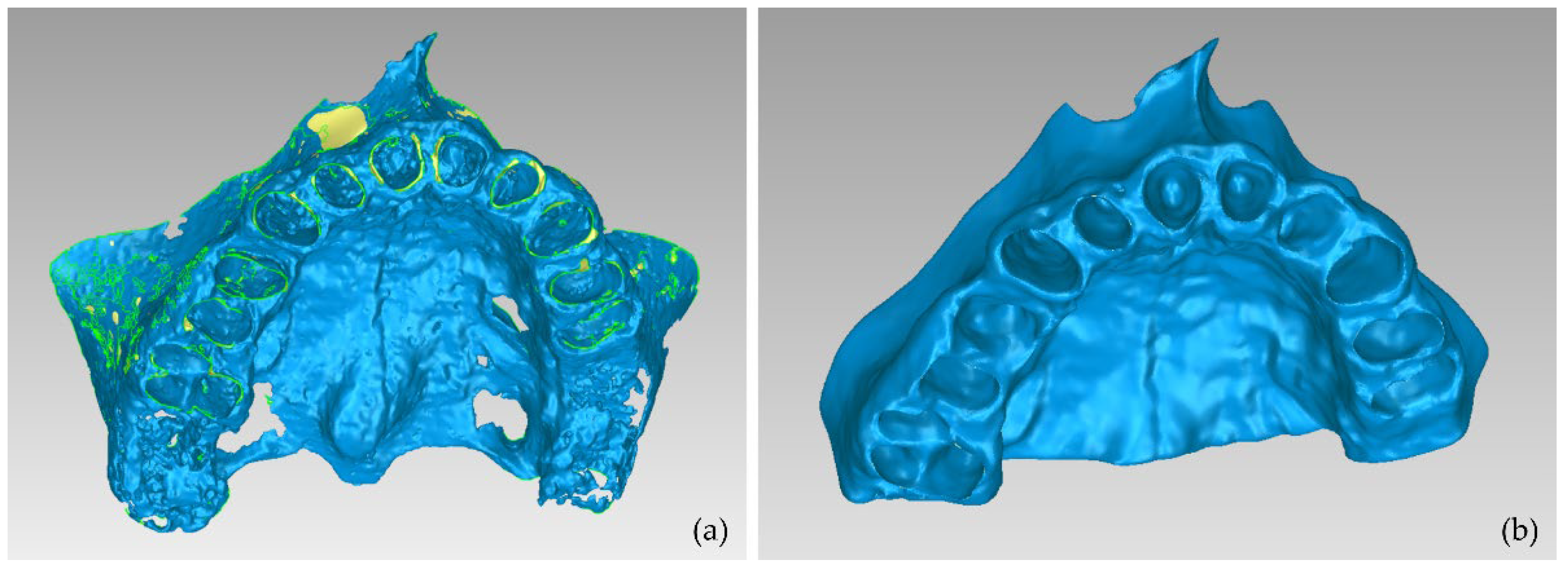 JPM | Free Full-Text | Evaluation of 3D Modeling Workflows Using Dental ...