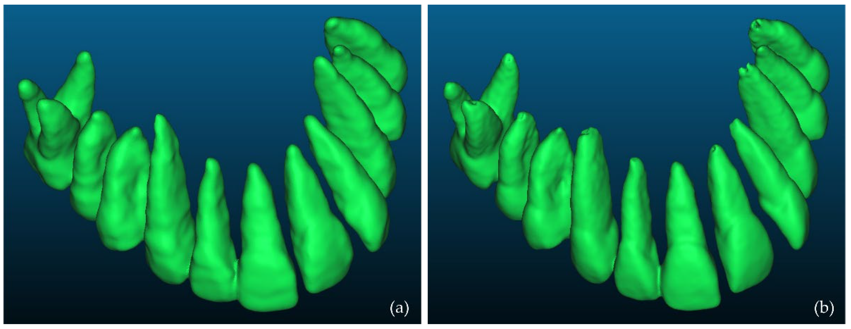 Evaluation of 3D Modeling Workflows Using Dental CBCT Data for ...