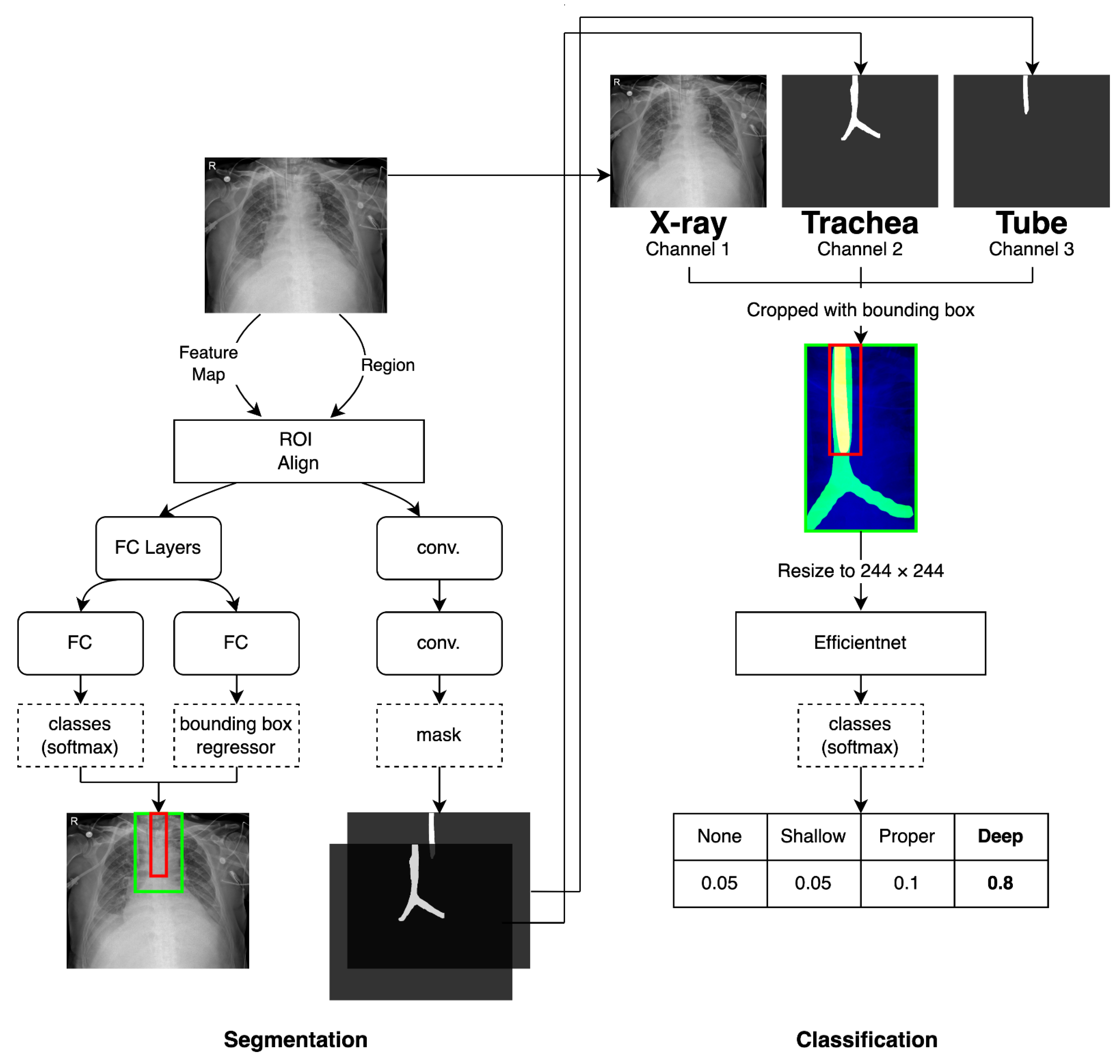 Position Classification of the Endotracheal Tube with Automatic ...
