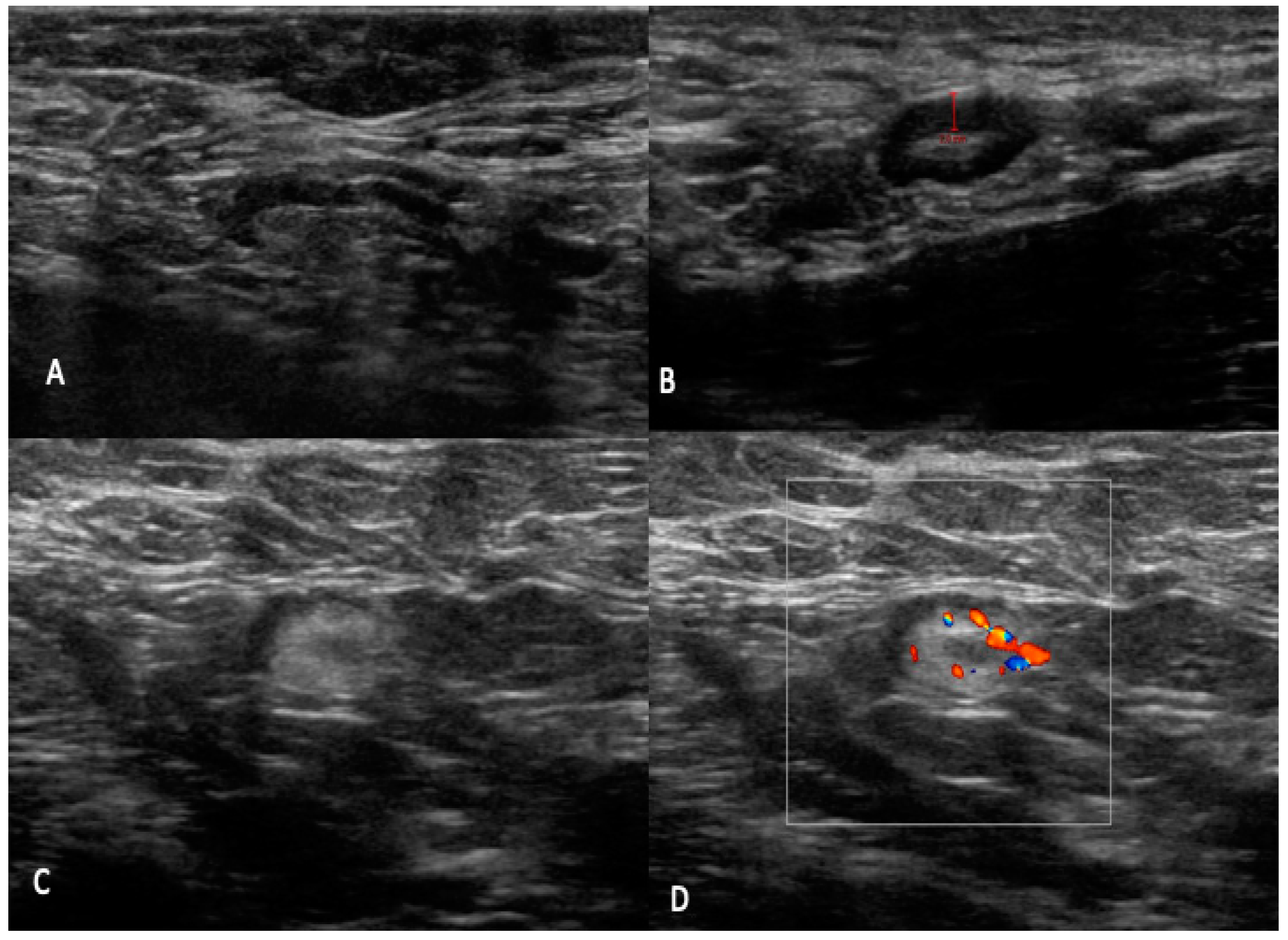 Easy Scheme Outlining the Various Morphological and Vascular ...