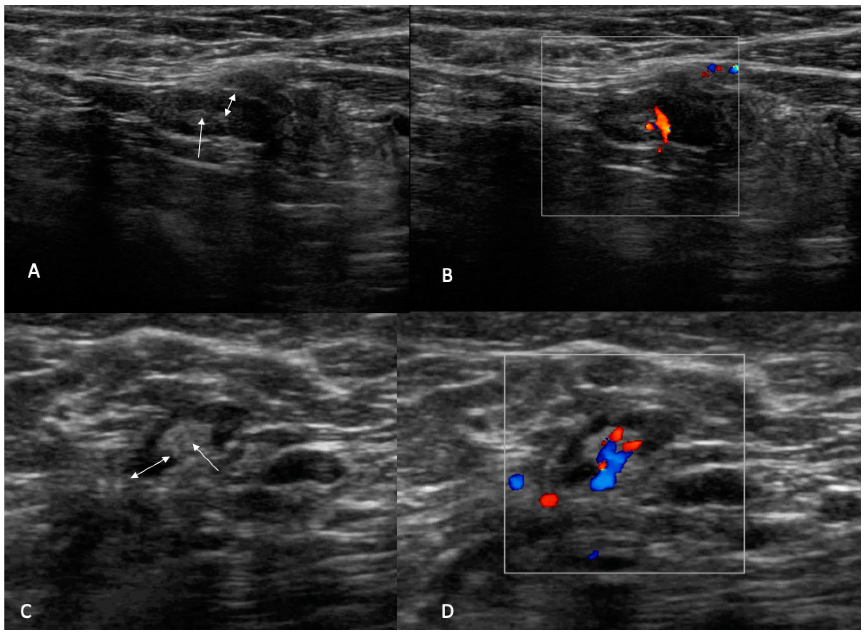 Easy Scheme Outlining the Various Morphological and Vascular ...