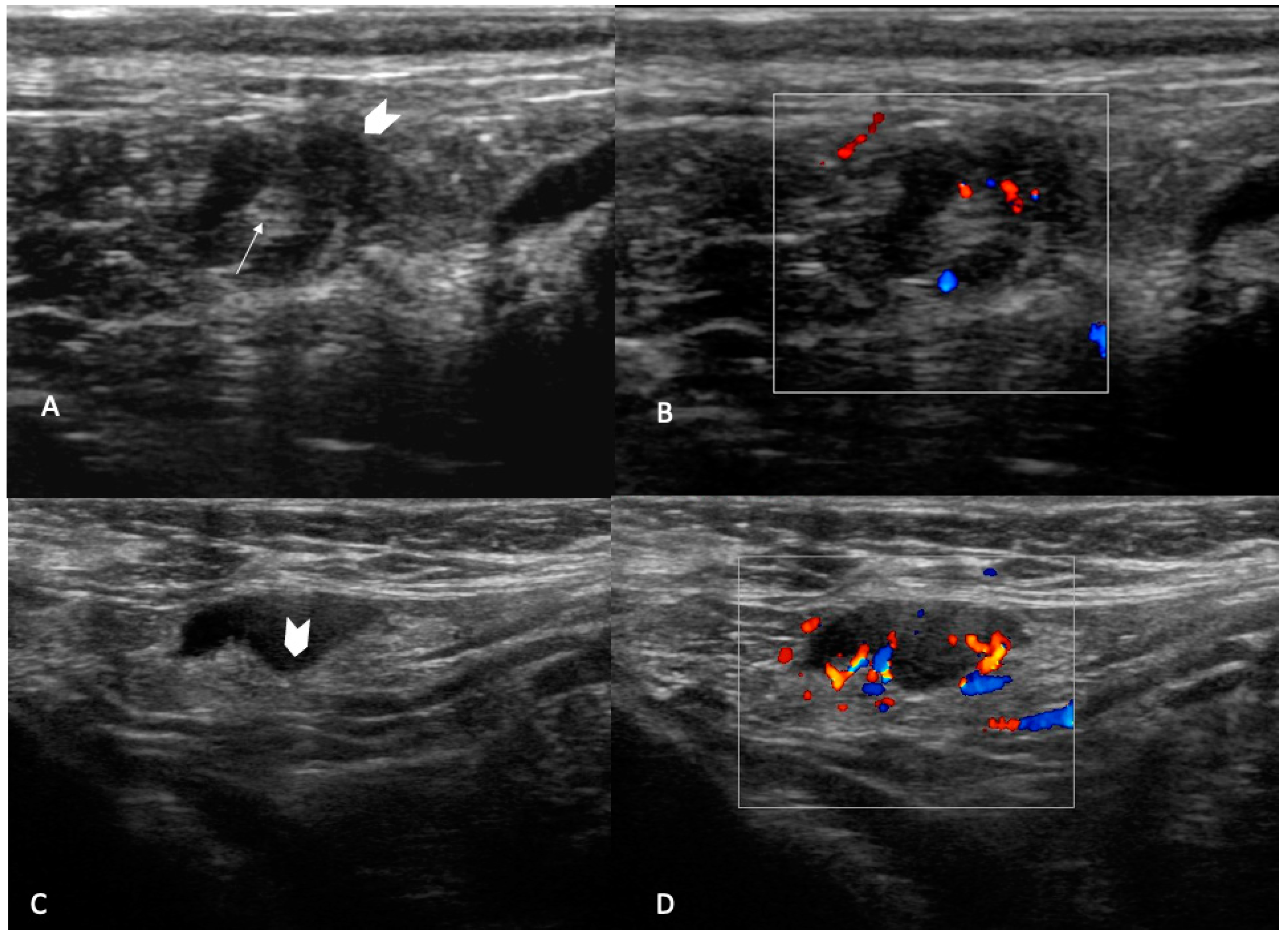 Easy Scheme Outlining the Various Morphological and Vascular ...