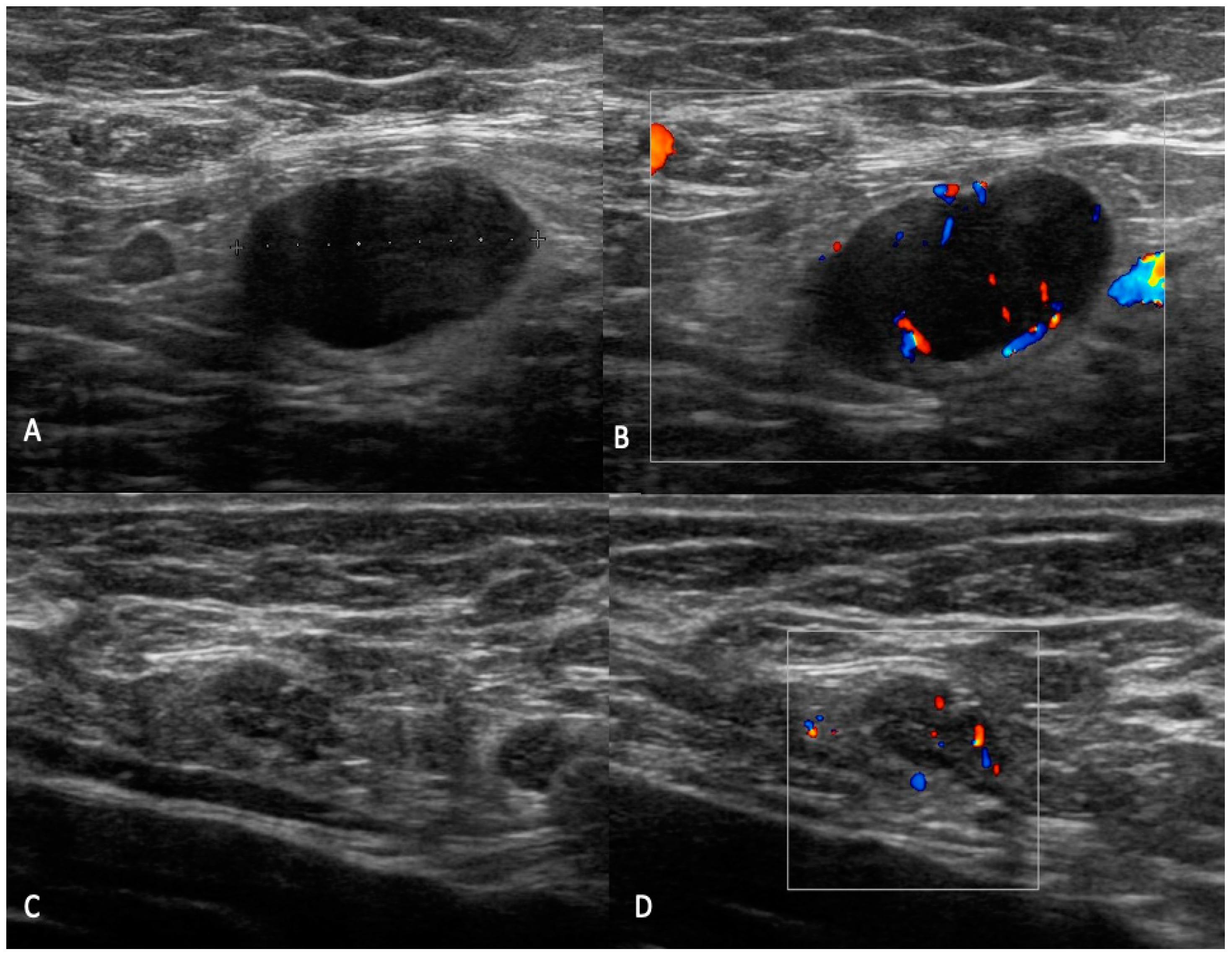 Easy Scheme Outlining the Various Morphological and Vascular ...