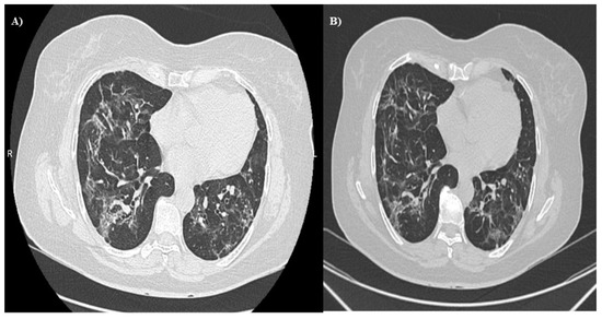 JPM | Free Full-Text | Challenges in the Management of Post-COVID-19 ...