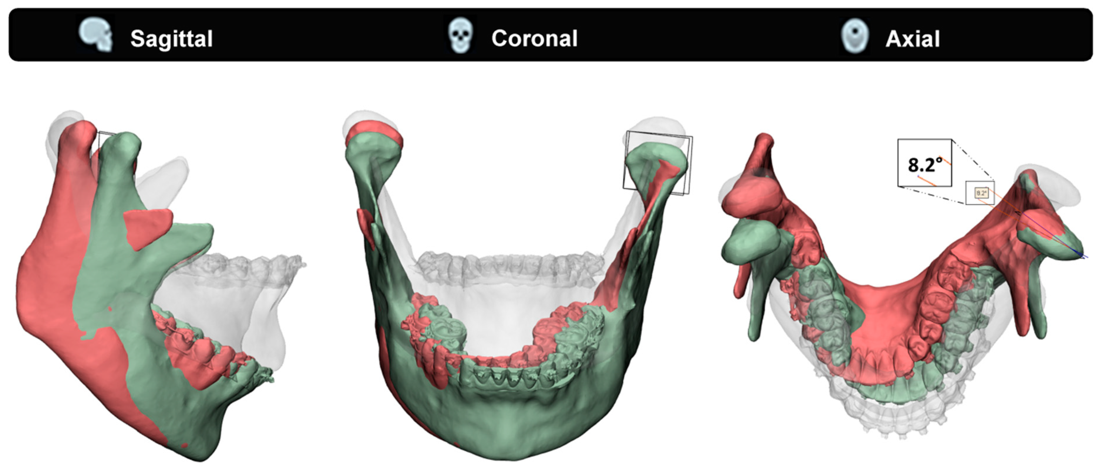 Four-Dimensional Determination of the Patient-Specific Centre of Rotation for Total ...