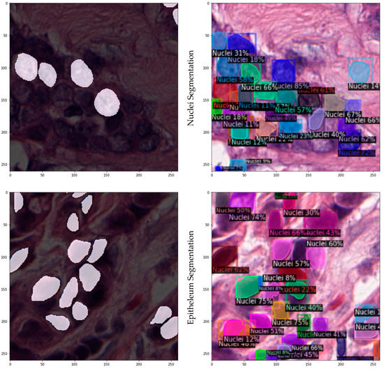 Image Analysis in Digital Pathology Utilizing Machine Learning and Deep ...