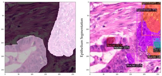 Image Analysis in Digital Pathology Utilizing Machine Learning and Deep ...