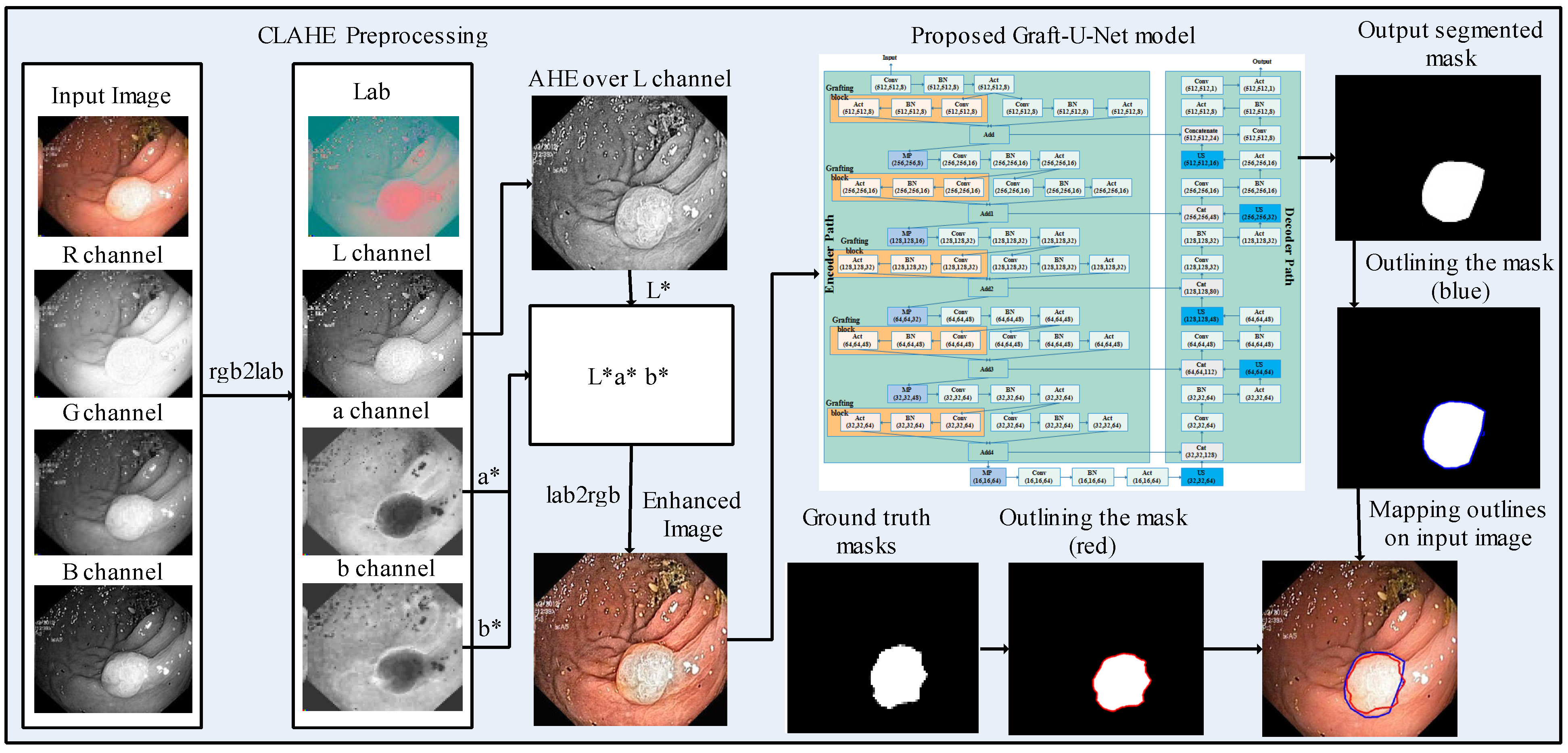 Jpm Free Full Text Gastrointestinal Tract Polyp Anomaly Segmentation On Colonoscopy Images