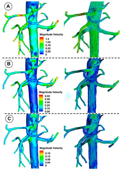 Patient-Specific Image-Based Computational Fluid Dynamics Analysis of ...