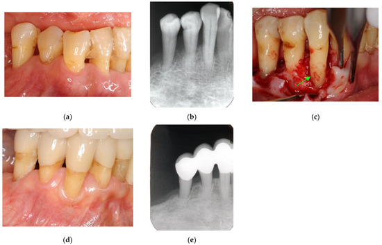 Personalized Medicine Based on the Pathogenesis and Risk Assessment of ...