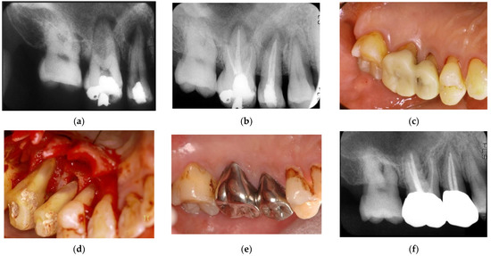 Personalized Medicine Based on the Pathogenesis and Risk Assessment of ...