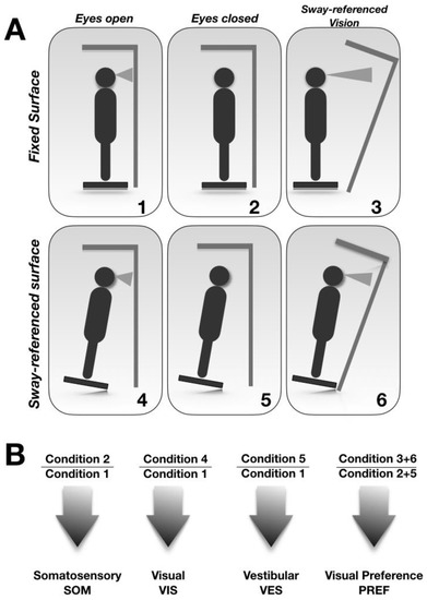 Posturographic Analysis in Patients Affected by Central and Peripheral ...