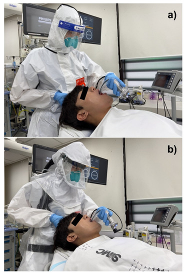 Endotracheal Intubation Using C-MAC Video Laryngoscope vs. Direct ...