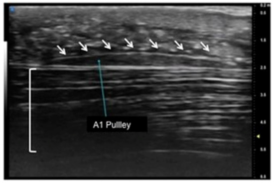Clinical Application of Ultra-High-Frequency Ultrasound